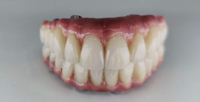 Full Arch Restorations - Omni Dental
