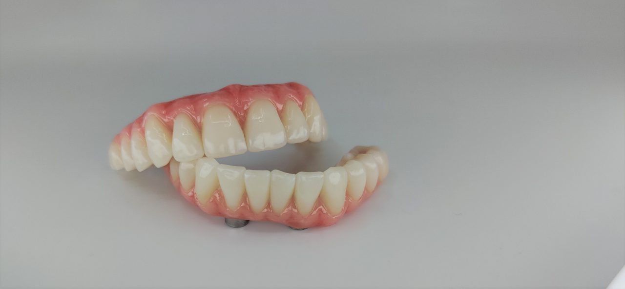 Full Arch Restorations - Omni Dental